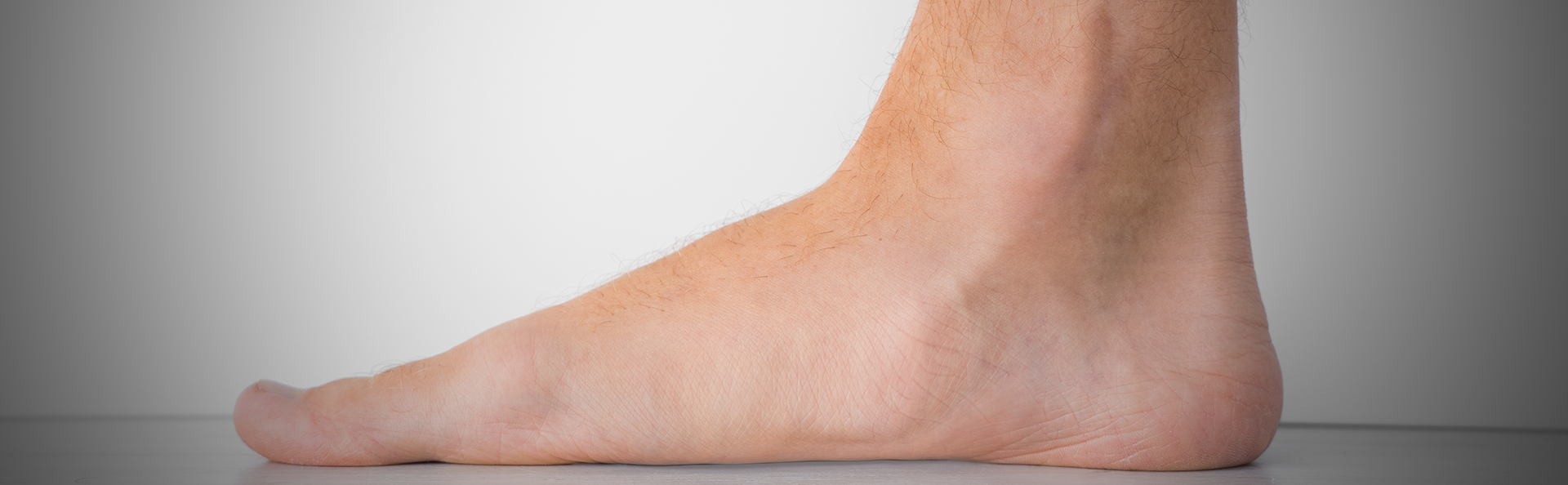 ¿Cómo saber si tengo el pie plano? | Piédica